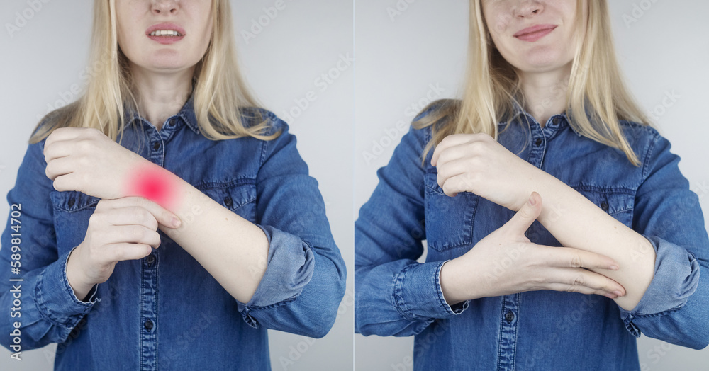 Before and after. In left woman is tormented by pain in her arm, hand ...