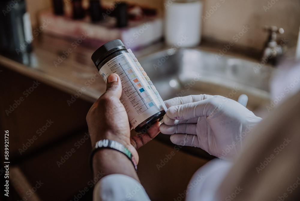 urinary test stripes in laboratory Stock Photo | Adobe Stock
