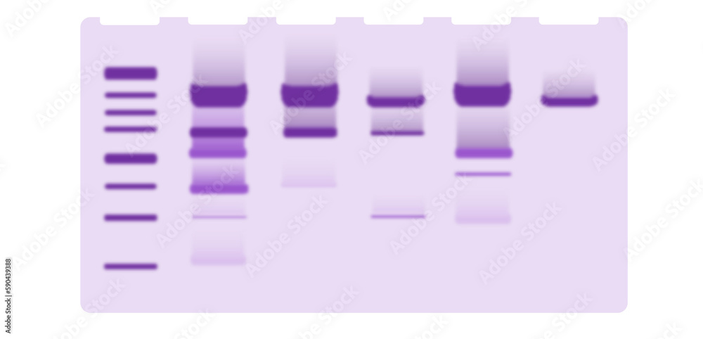 Illustration of protein gel electrophoresis. SDS page illustration foto ...