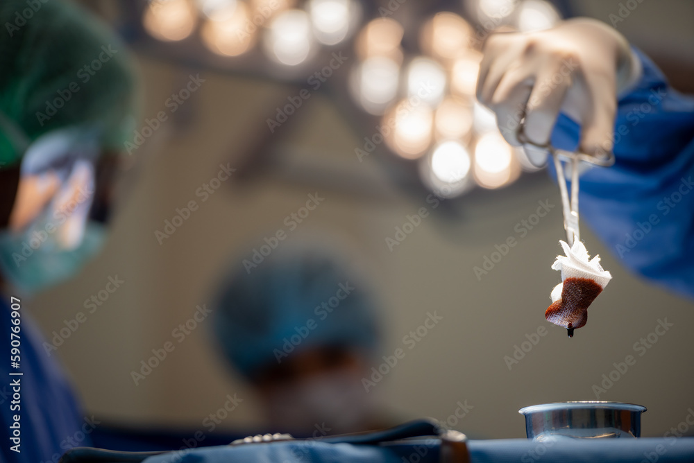 Hand of surgery doctor in Operating Room hold operating plier forceps ...