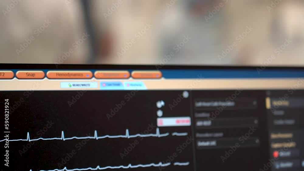 Kyiv, Ukraine - April 2023: Heart Institute. The patient monitor shows ...