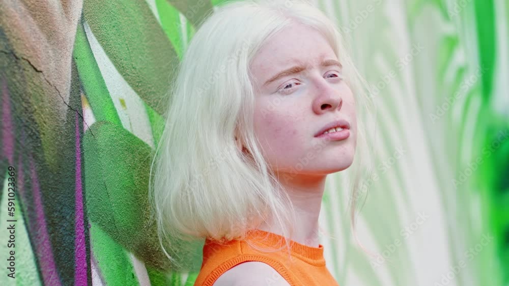 Pretty stylish albino teen generation z girl, cute inclusive beautiful ...