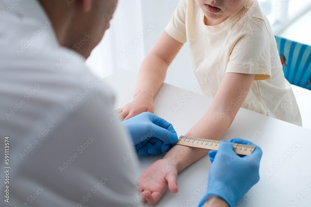 A male doctor makes an important Mantoux test on a child. The doctor ...