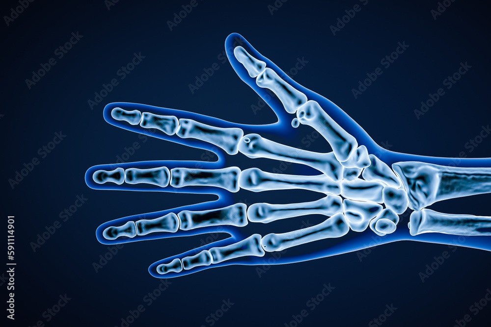 X-ray palmar or anterior view of right human hand bones with body ...