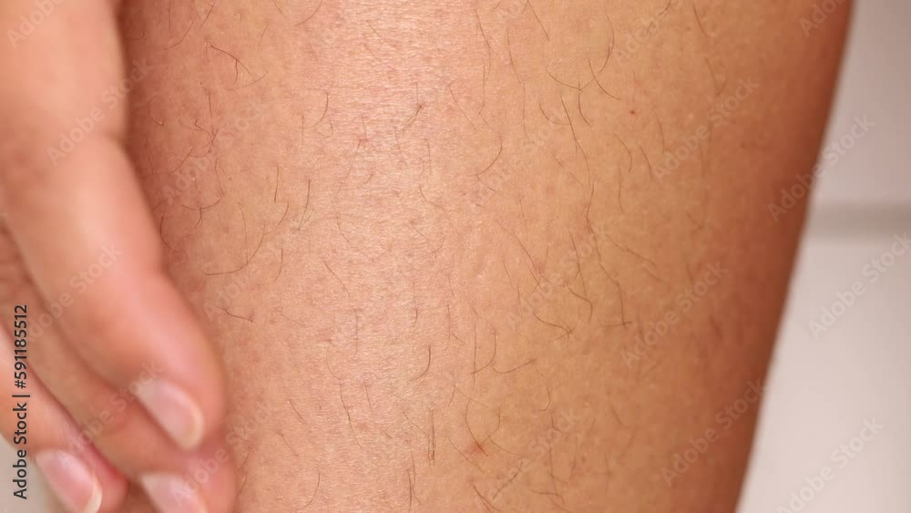 Female hand stroking hairy legs against hair growth closeup. Body skin ...