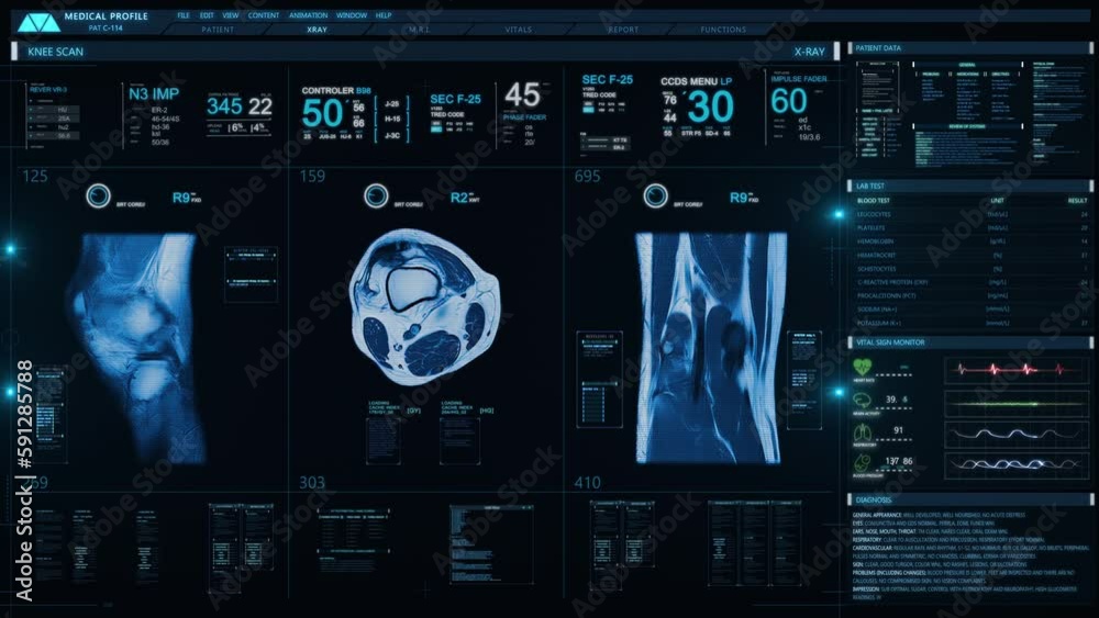 Medical Profile of Patient Showing Knee MRI Scan, Joint Region, Vital ...