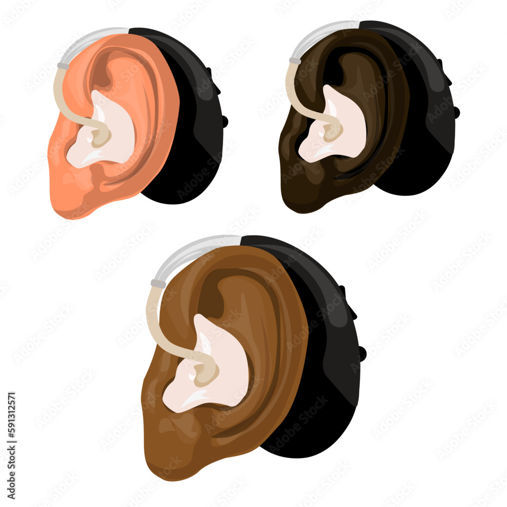 vector of skin tones ear with hearing aid device. for deaf and ...