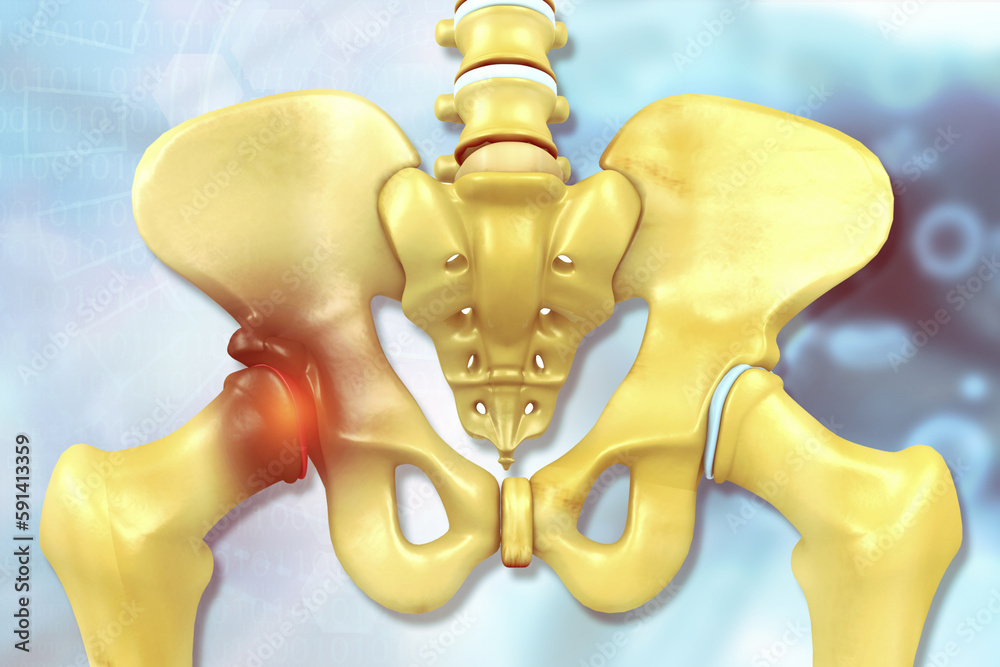 Human hip anatomy. Femoral head pain. 3d illustration. Stock ...