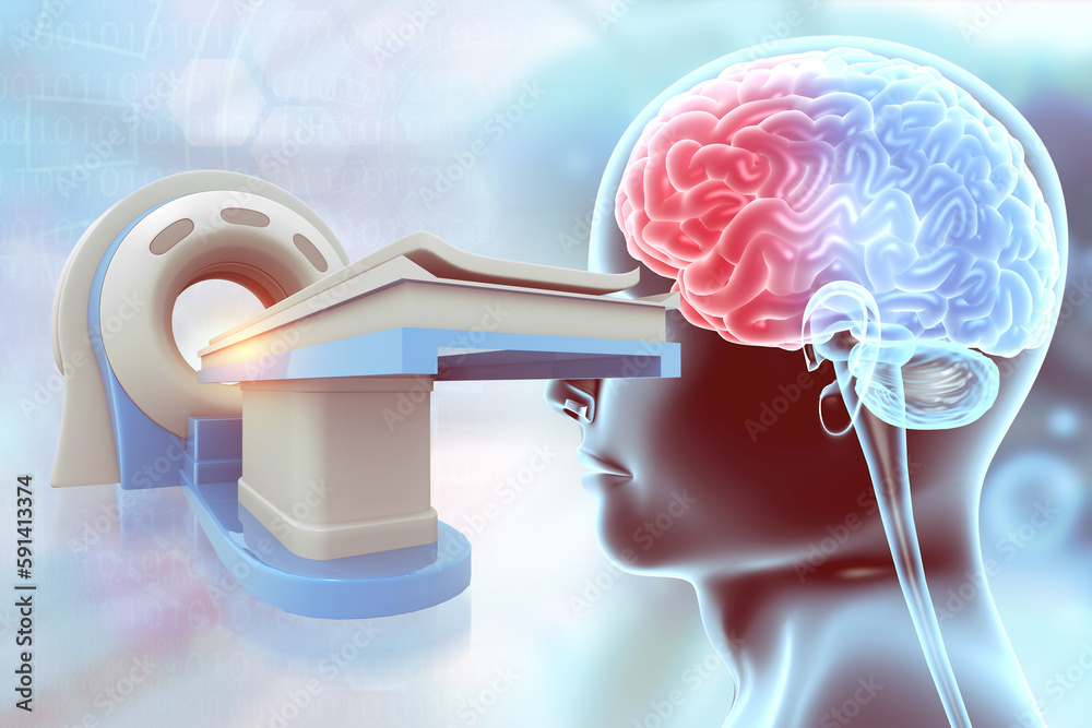 CT scan machine with human brain anatomy. 3d illustration. Stock ...