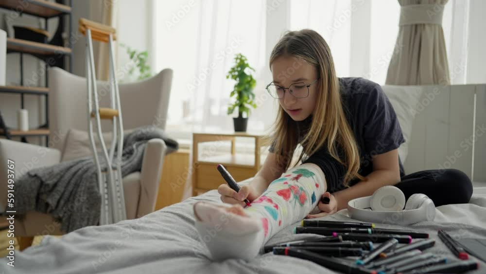 Teenager girl paints on cast leg with felt-tip pens. Young woman draws ...