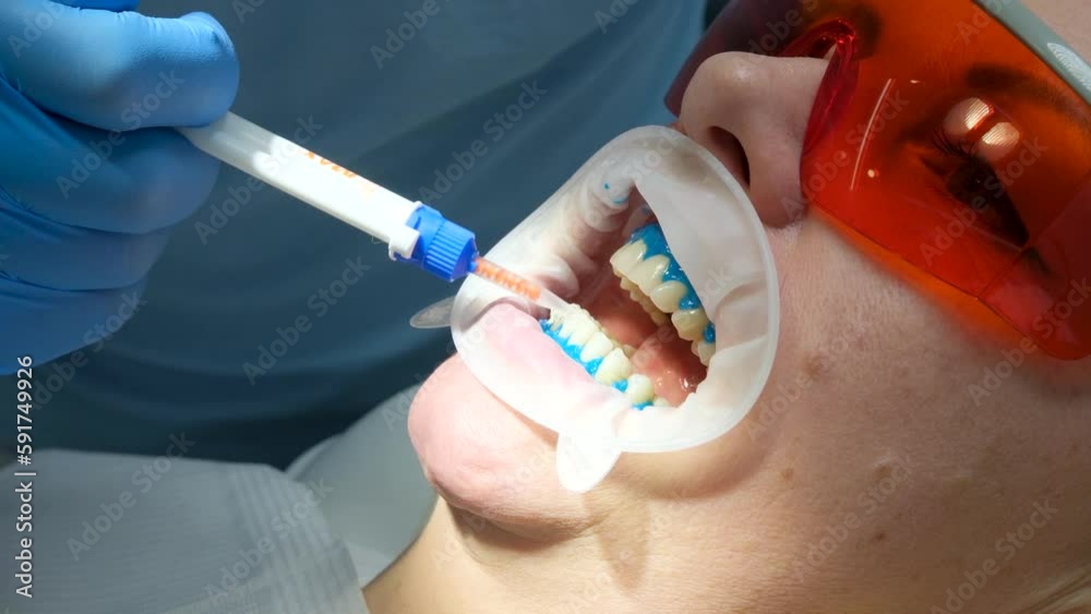close-up of a woman's face under apparatus Beyond Poluse Plus Advanced ...
