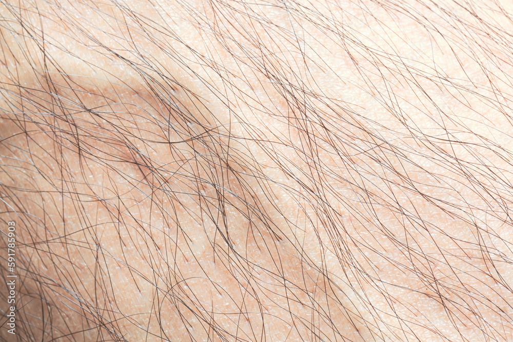 Macro human skin and hair,Hair on the body of the macro Stock Photo ...