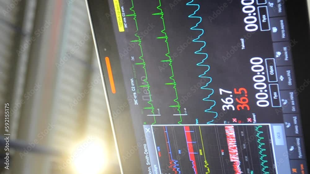 Modern patient monitor. Electronic Health Monitor displaying medical ...