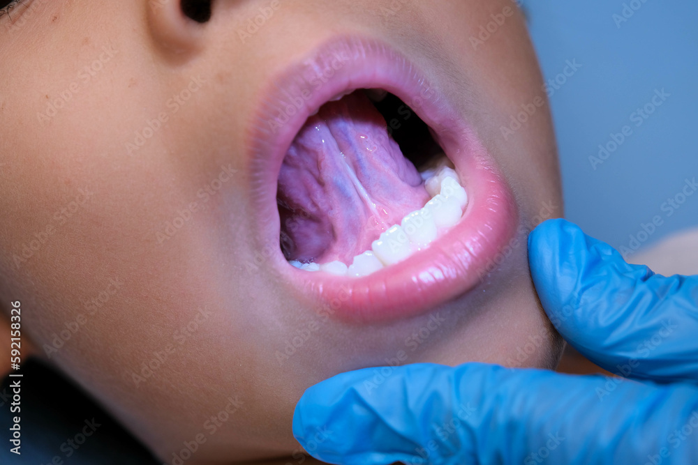 Foto de Close-up inside the oral cavity of a healthy child with ...
