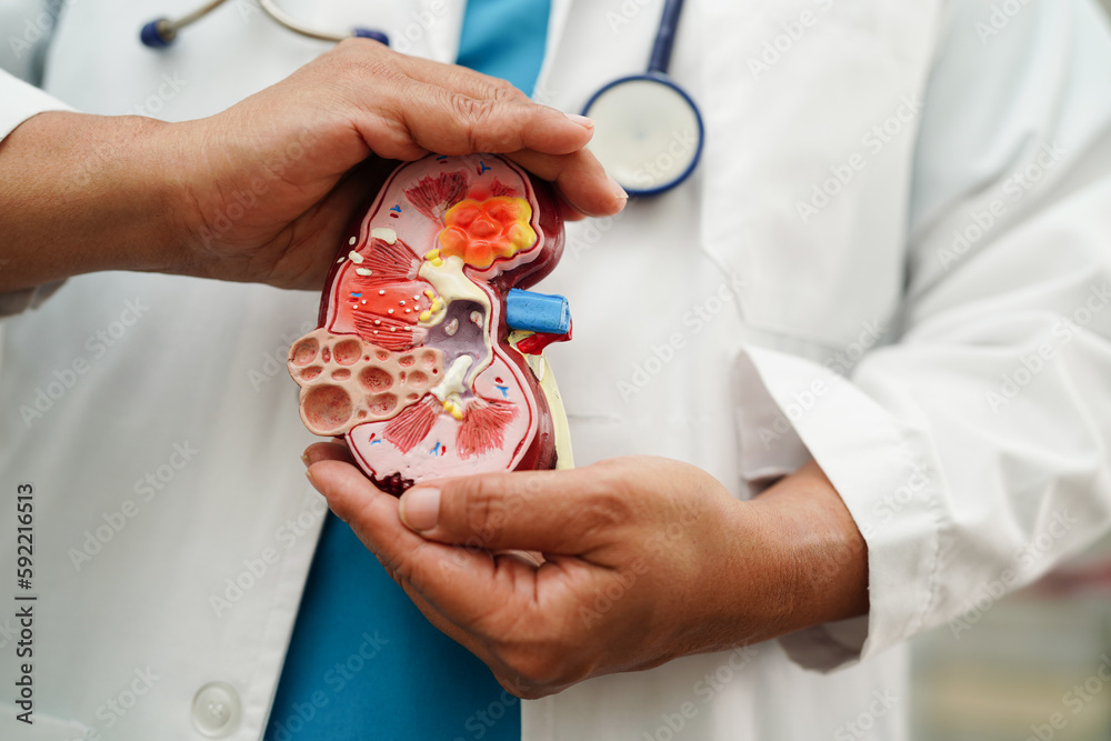 Chronic kidney disease, doctor holding model for treatment urinary ...