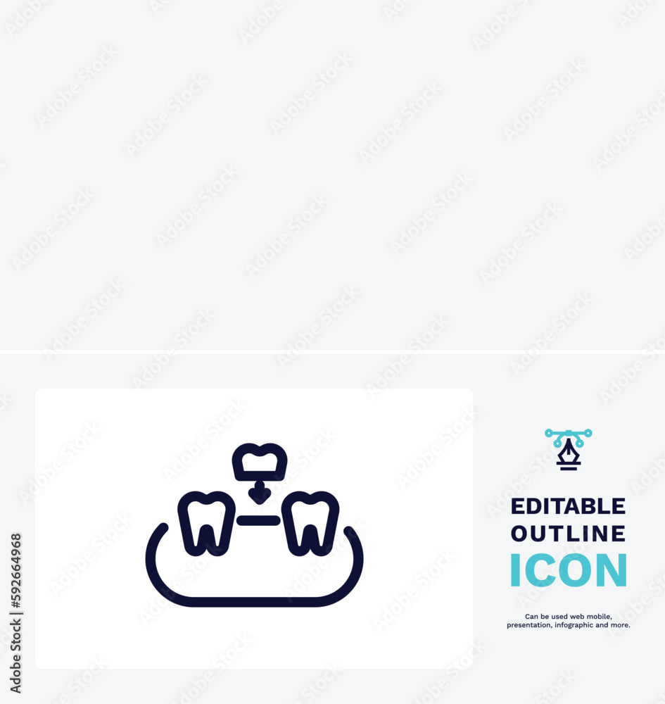 overdenture icon. Thin line overdenture icon from dental health ...