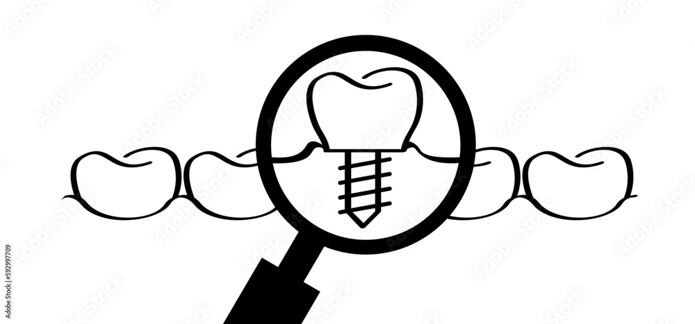 Dental implant, medically accurate or dental bridge. Cartoon healthy ...