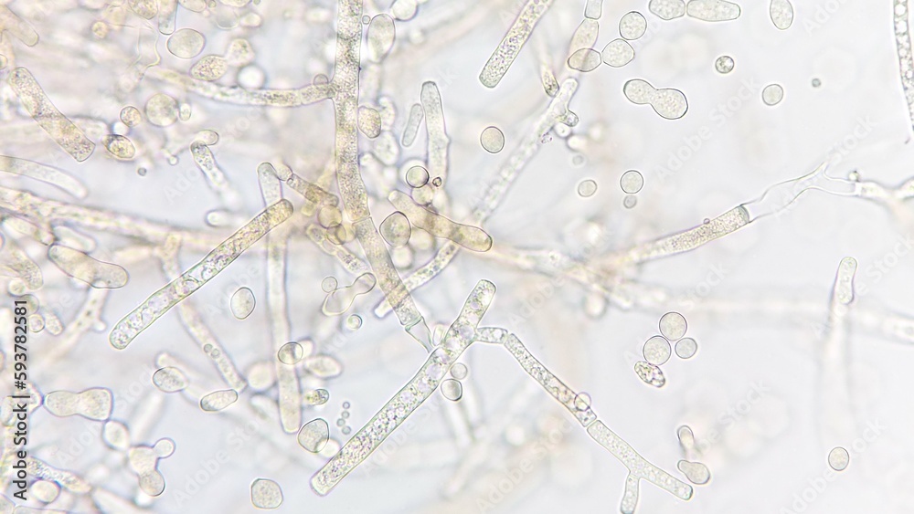 Neurospora sp. under microscope. Sample collected from corncob. Fresh ...