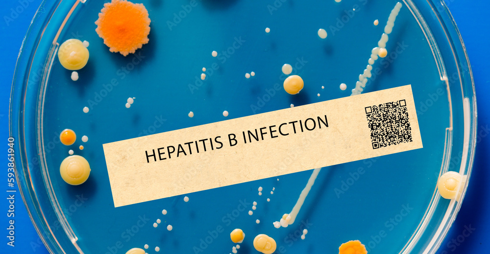 Hepatitis B - Viral infection that affects the liver and is transmitted ...