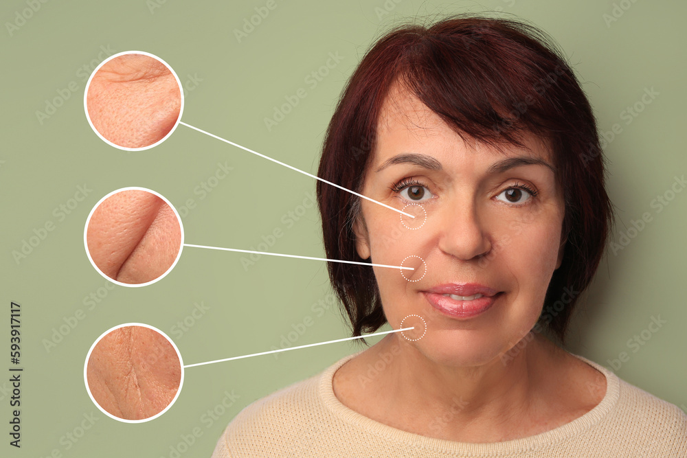 Beautiful mature woman on olive background. Zoomed skin areas showing ...