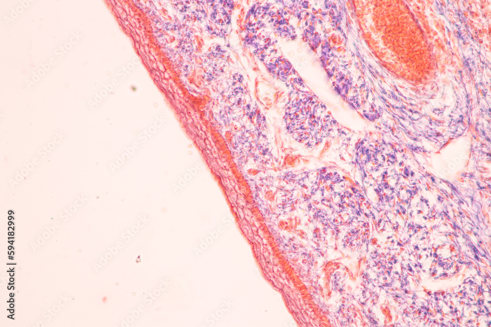 Anatomy and Histological Bone, Elastic cartilage human and Joint of ...