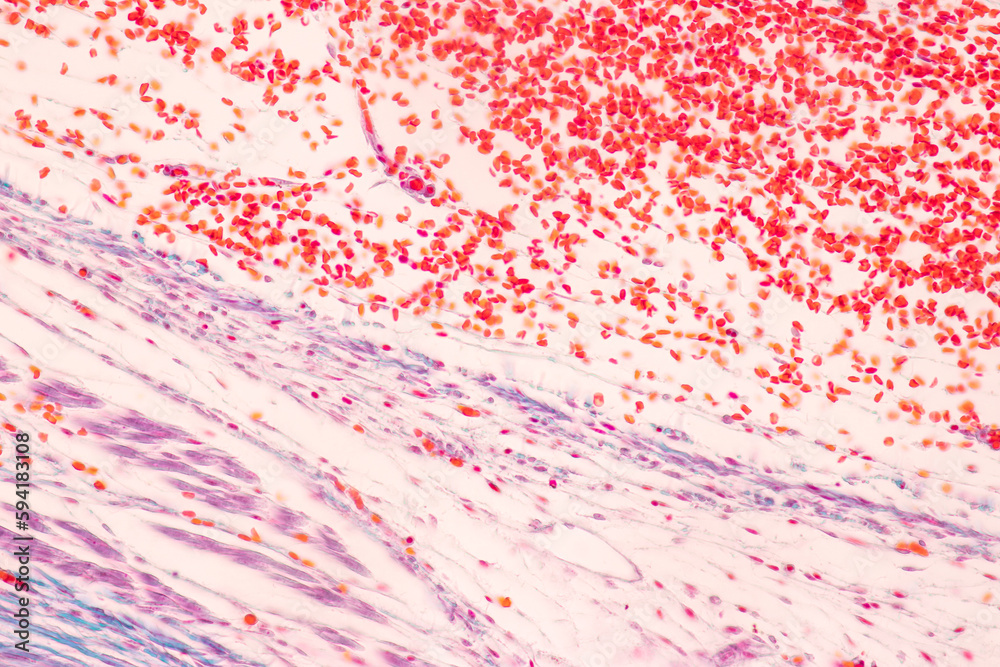 Anatomy and Histological Bone, Elastic cartilage human and Joint of ...