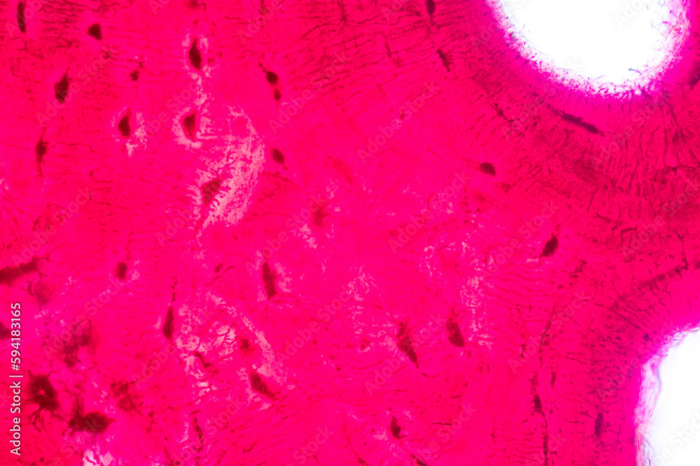 Anatomy and Histological Bone, Elastic cartilage human and Joint of ...