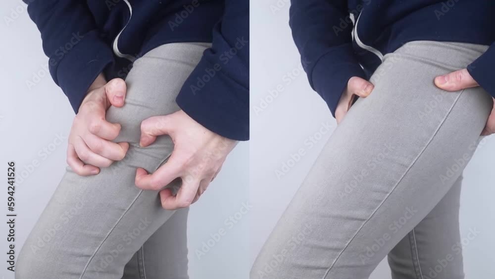 Before and after. On left, a woman has acute pain in the hip after a ...