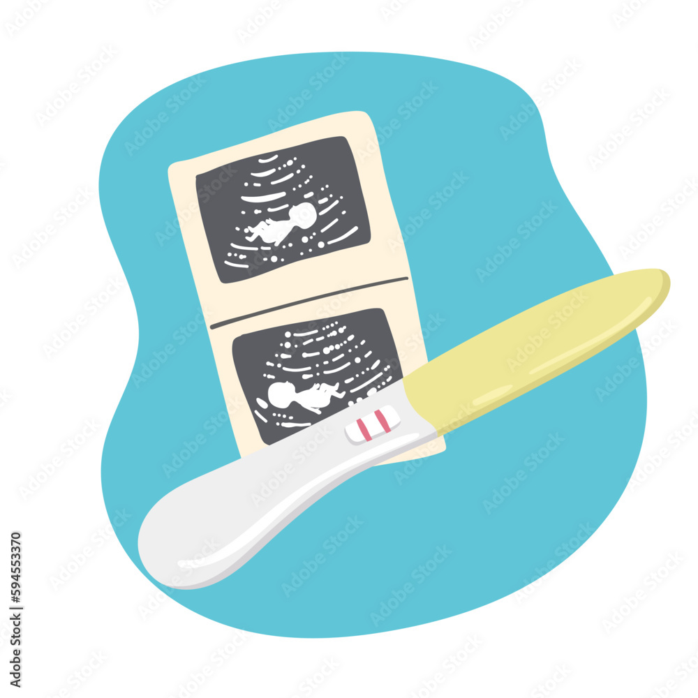 A positive pregnancy test result, a photo of a baby on an ultrasound ...