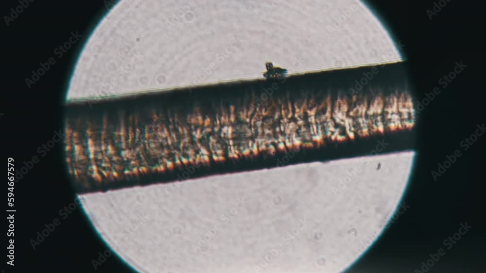 Single Human Hair Under A Microscope Microscopy Of Human Hair From The Head Real Detailed View
