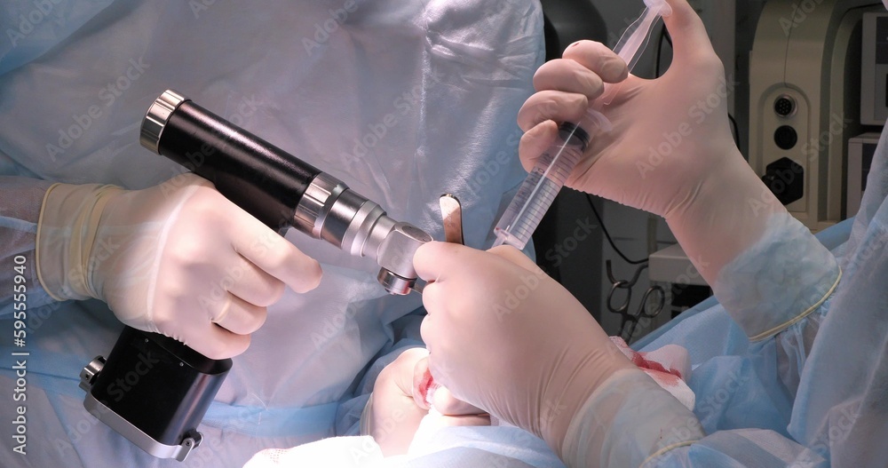 A veterinary surgeon cuts down a drilled section of a broken bone in a ...