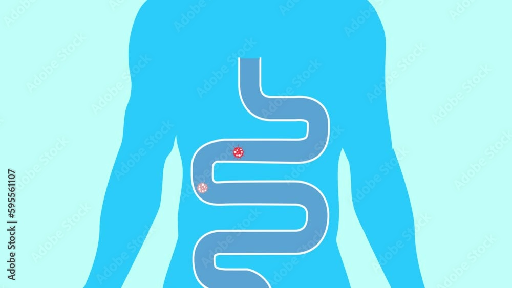 2D anatomy man suffering from intestine inflammatory bowel Disease ...