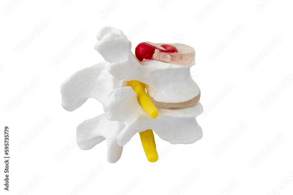 Isolated anatomy spine model on white space background.Orthopedic ...