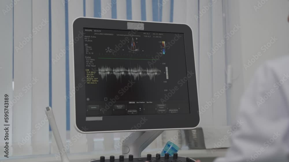 Doctor doing a doppler sonography a male patient in a cardiology clinic ...