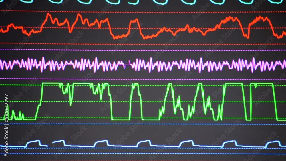 Modern patient monitor. Electronic Health Monitor displaying medical ...