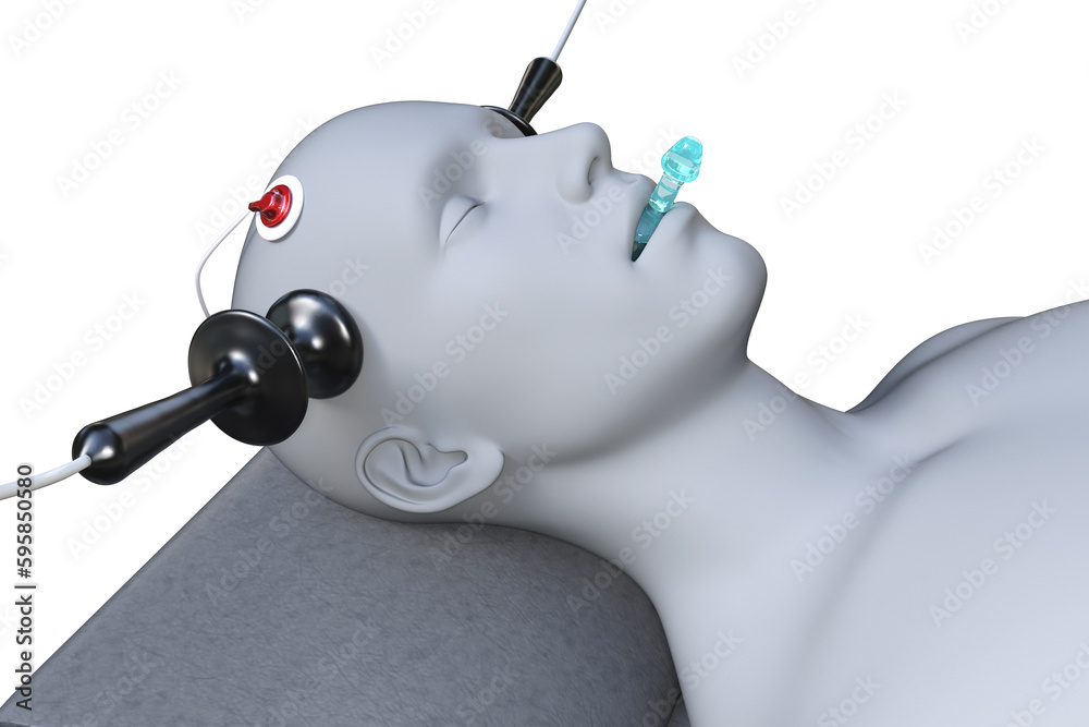 Electroconvulsive therapy, ECT, a treatment involving the use of ...
