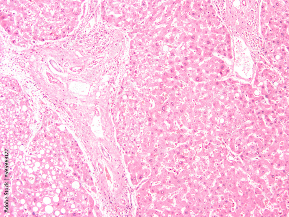 picture of histology human tissue with a microscope from the laboratory ...