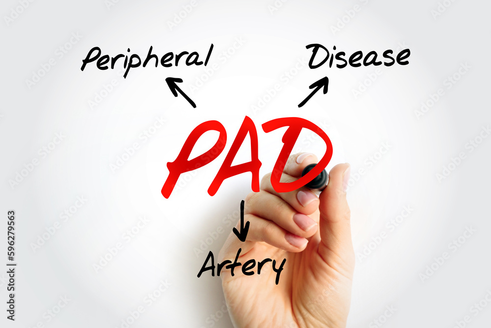 PAD Peripheral Artery Disease - circulatory problem in which narrowed ...