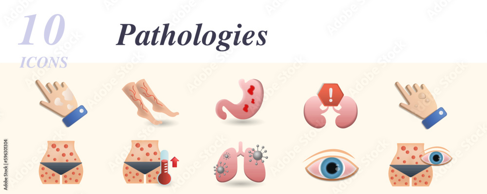 Pathologies set. Creative icons: vitiligo, varicose, ulcers, uremia ...