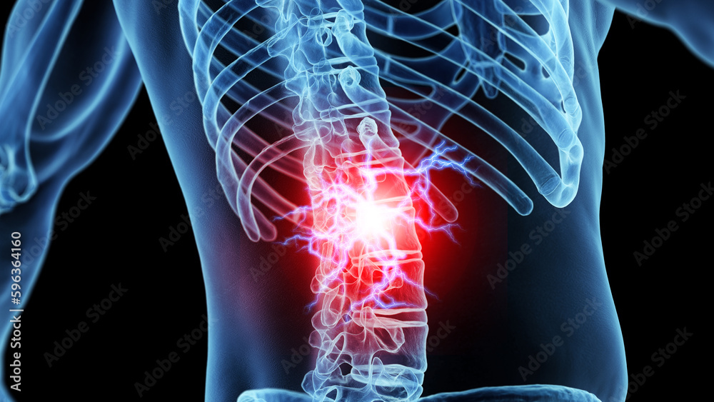 3d medical illustration of lower back pain Stock Illustration | Adobe Stock