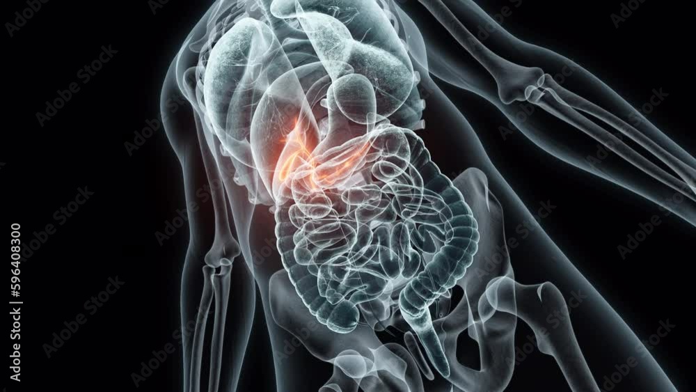 3D rendering Medical Animation of a Human Gallbladder.X-ray of a ...