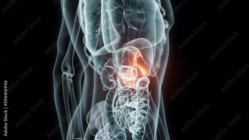 3D rendering Medical Animation of a Human Gallbladder.X-ray of a ...
