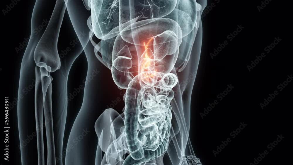 3D rendering Medical Animation of a Human Gallbladder.X-ray of a ...