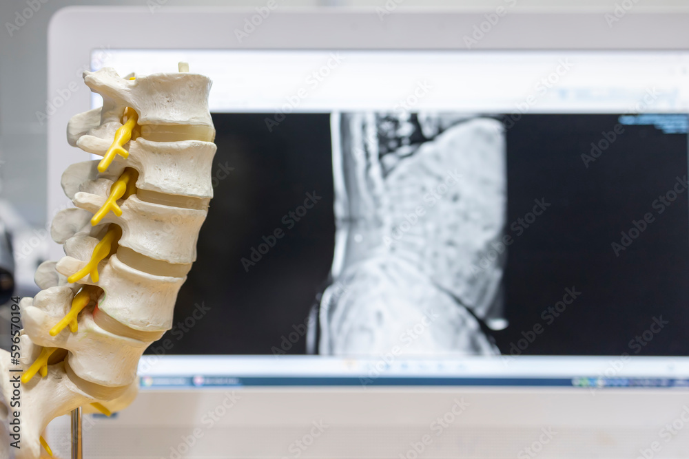 Spine model or mock up inside orthopedic unit in hospital with computer ...