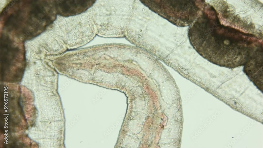 Worm from family Naididae under a microscope, possibly Tubifex. Found ...