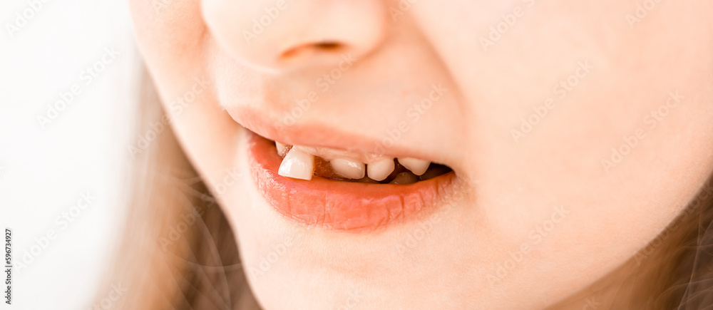 Charming smiling little girl kid with opened mouth shows staggering ...