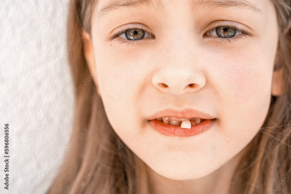 Foto de Charming smiling little girl kid with opened mouth shows ...