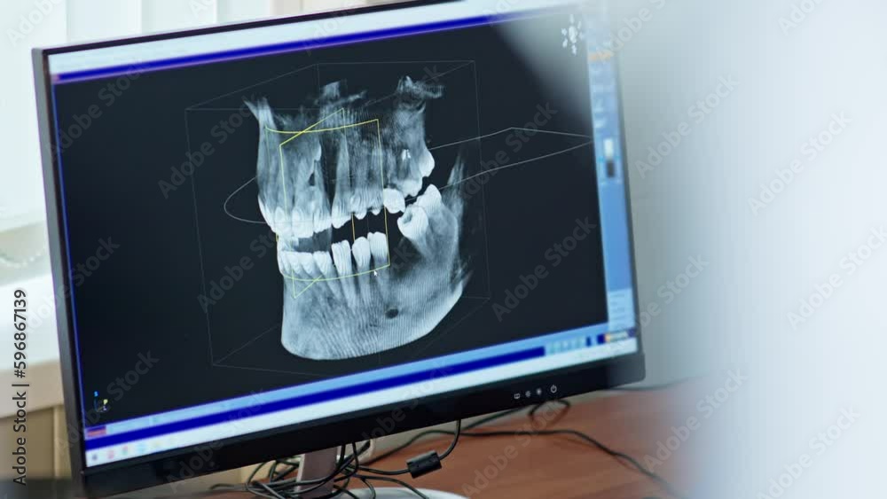 Dentist looking 3d model of x-ray of patient's jaw. 3d model of teeth ...