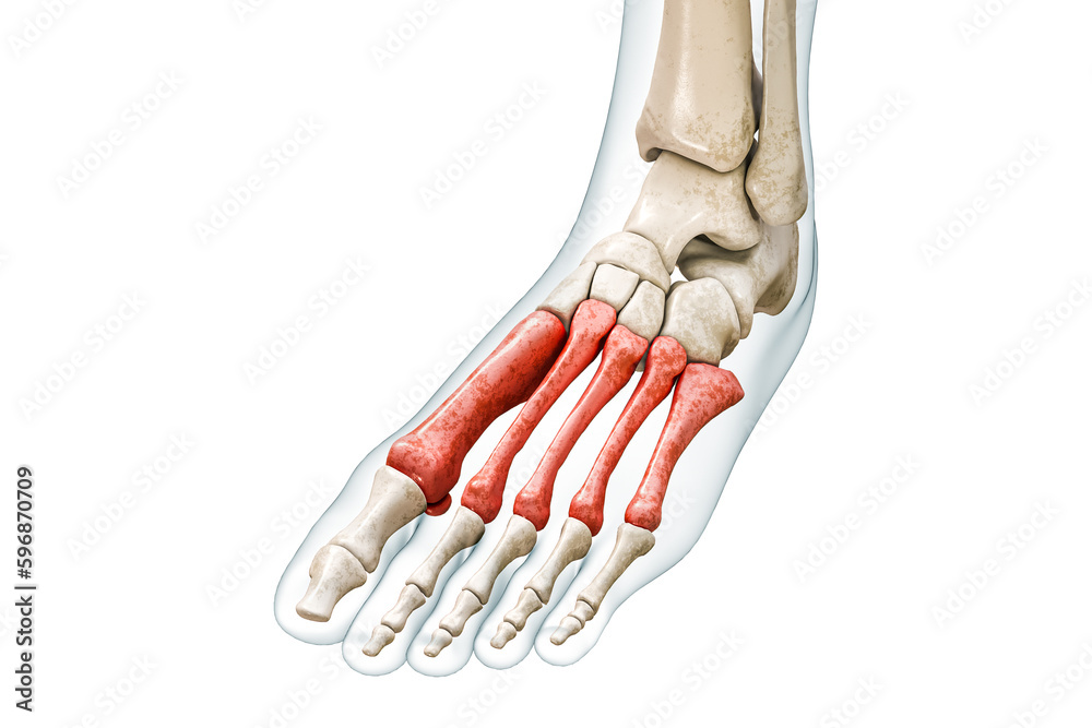 Metatarsal bones or metatarsus in red with body 3D rendering ...