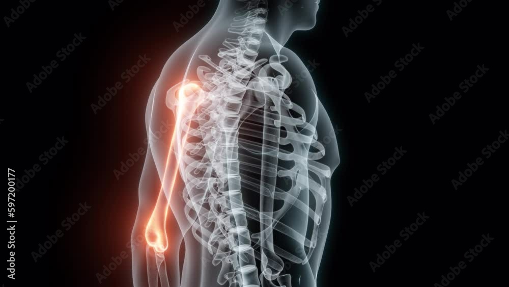 3D rendering of a medical animation of a Humerus. X-ray of a human ...